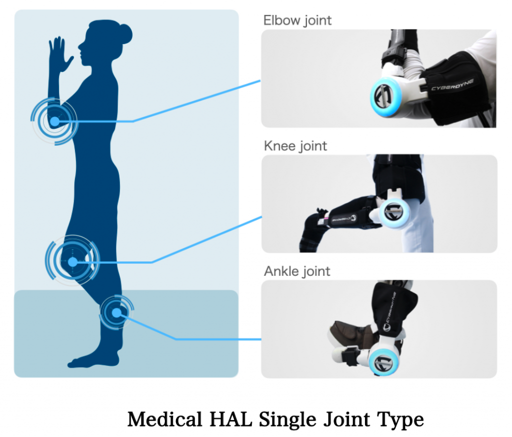 【News】Medical HAL Single Joint Type receives medical device approval ...
